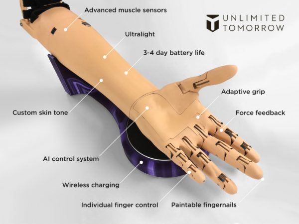 Top 15 prosthetics made with 3D printing - Bitfab