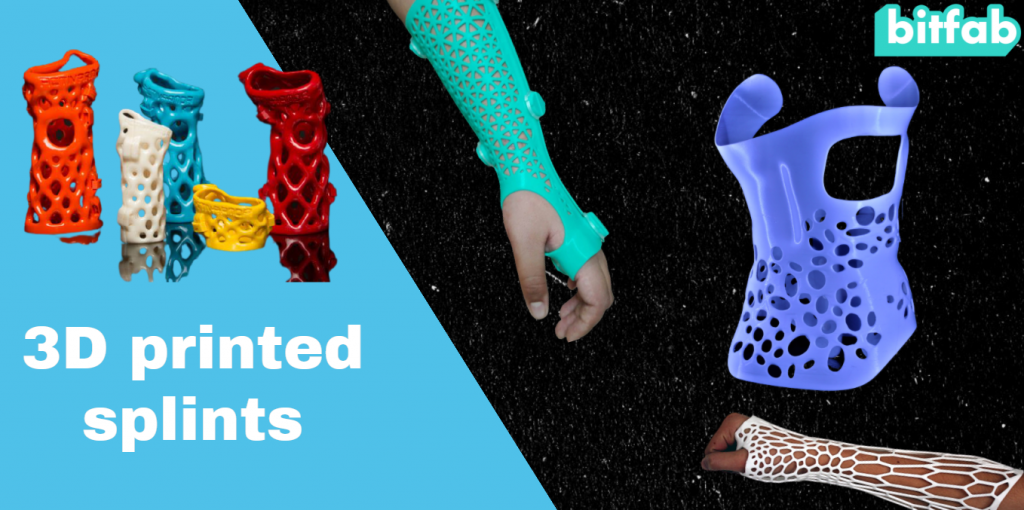 All About 3D-Printed Splints - Bitfab