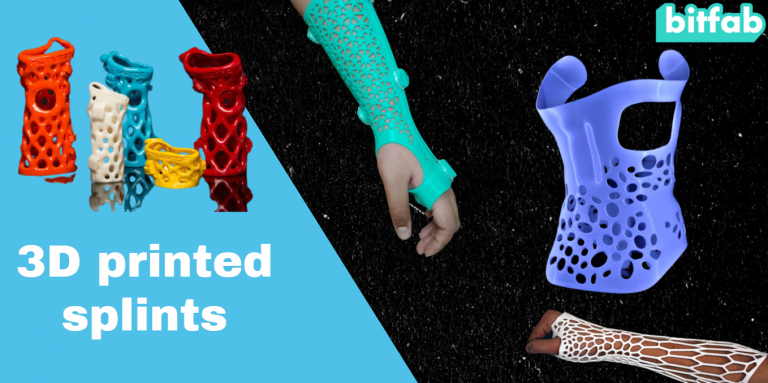 All About 3D-Printed Splints - Bitfab