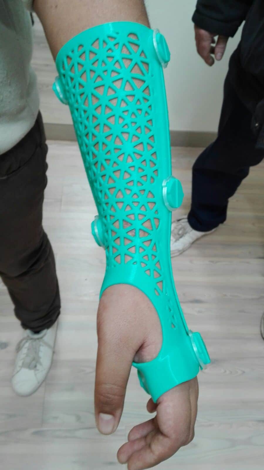 All About 3D-Printed Splints - Bitfab